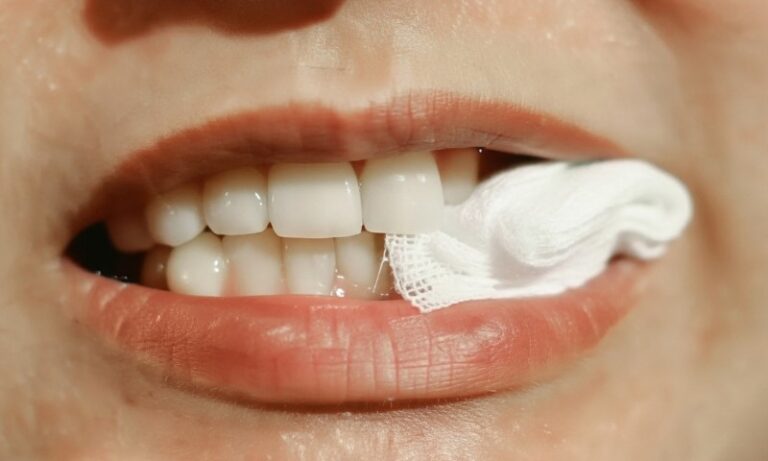 Tooth Extraction Healing Process - What to Expect After Your Procedure?